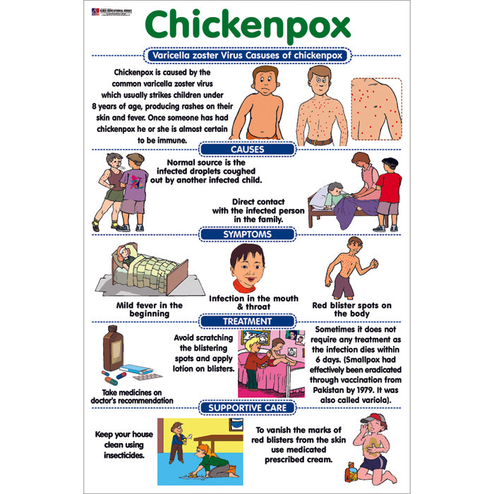 Chickenpox Chart Global Chickenpox Vaccine Market Share, Size